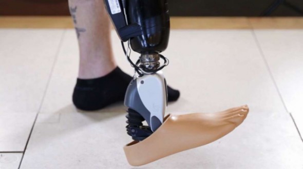 Proprio ขาเทียมเเบบใหม่ สั่งควบคุมความเคลื่อนไหวด้วยจิตใจของเรา!!